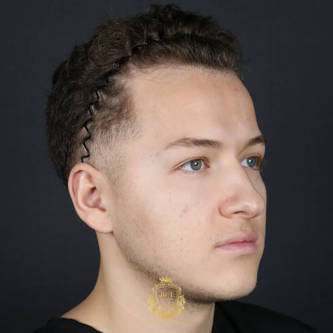 Best Haircuts for a Receding Hairline (Men’s Styles That Flatter ...